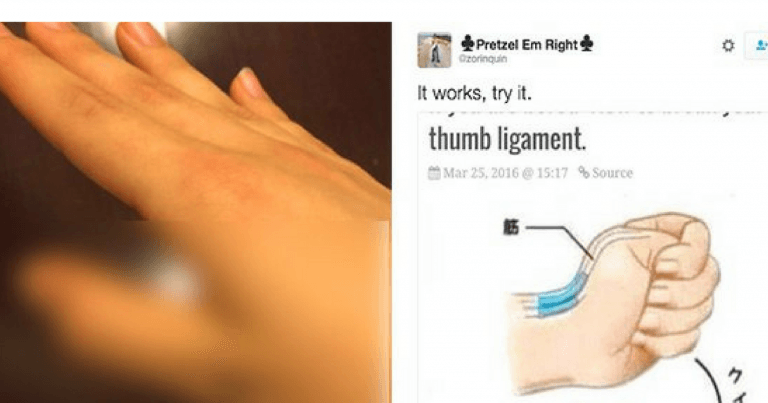 What happens when you break your thumb ligament - subtitleready