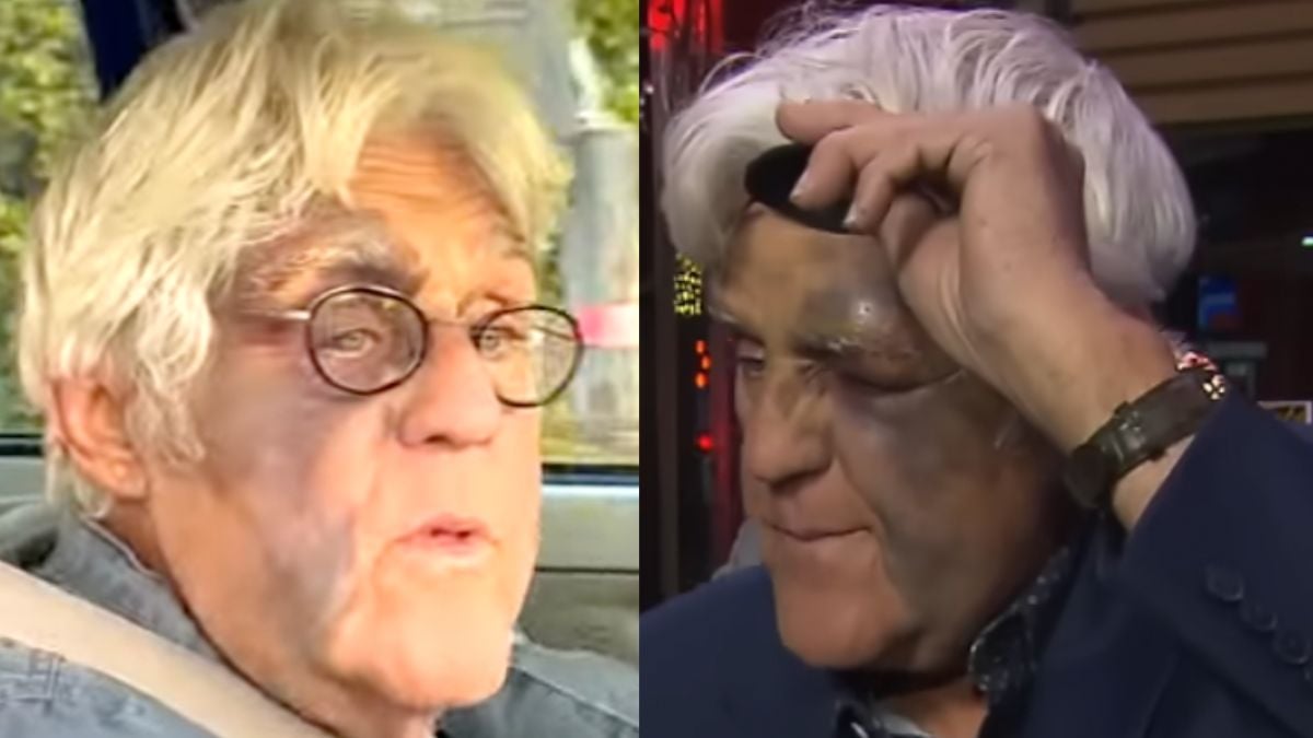 Jay Leno Breaks His Silence To Address Claims His Facial Injuries Stemmed From Being Beaten Up ...